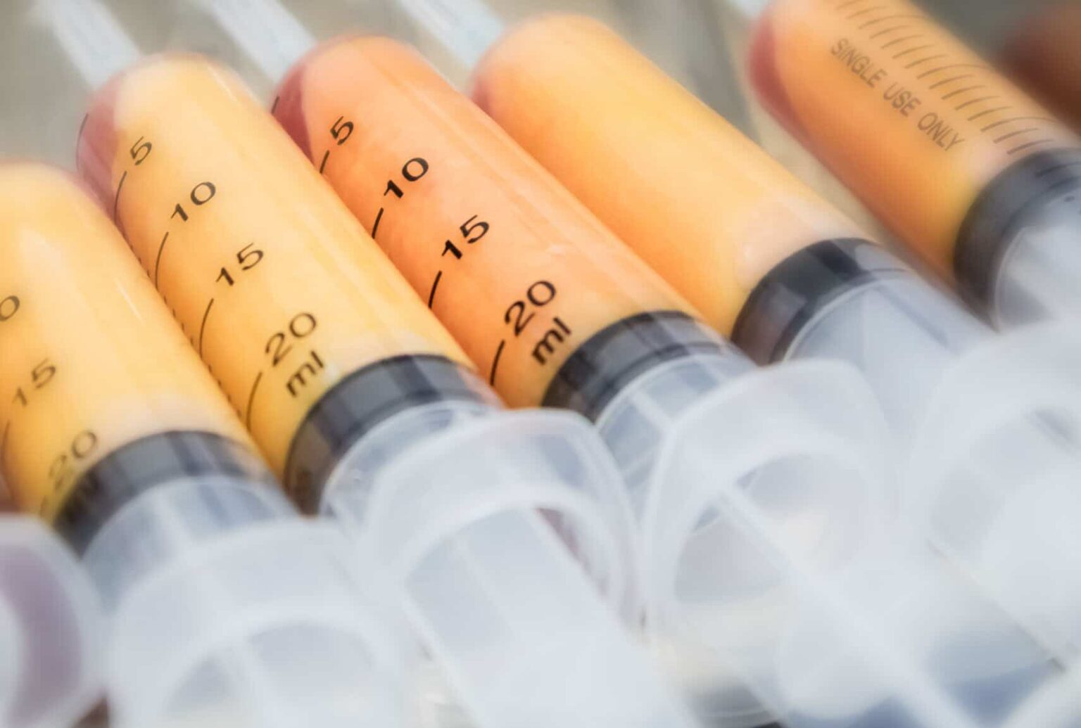 Exclusive breast lipofilling by liposuction | Paris Breast Center